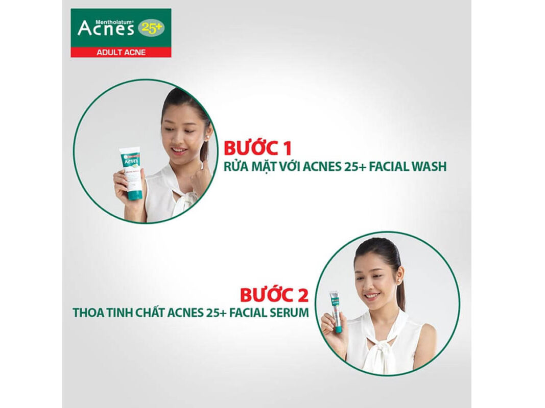 Acnes 25+ Facial Serum: Tinh chất chuyên biệt dành cho da bị mụn - Dược ...